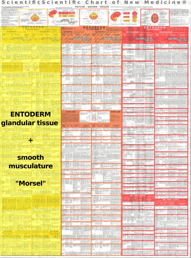 Tonsil Cancer left - Diagnostic Chart - GHk Academy