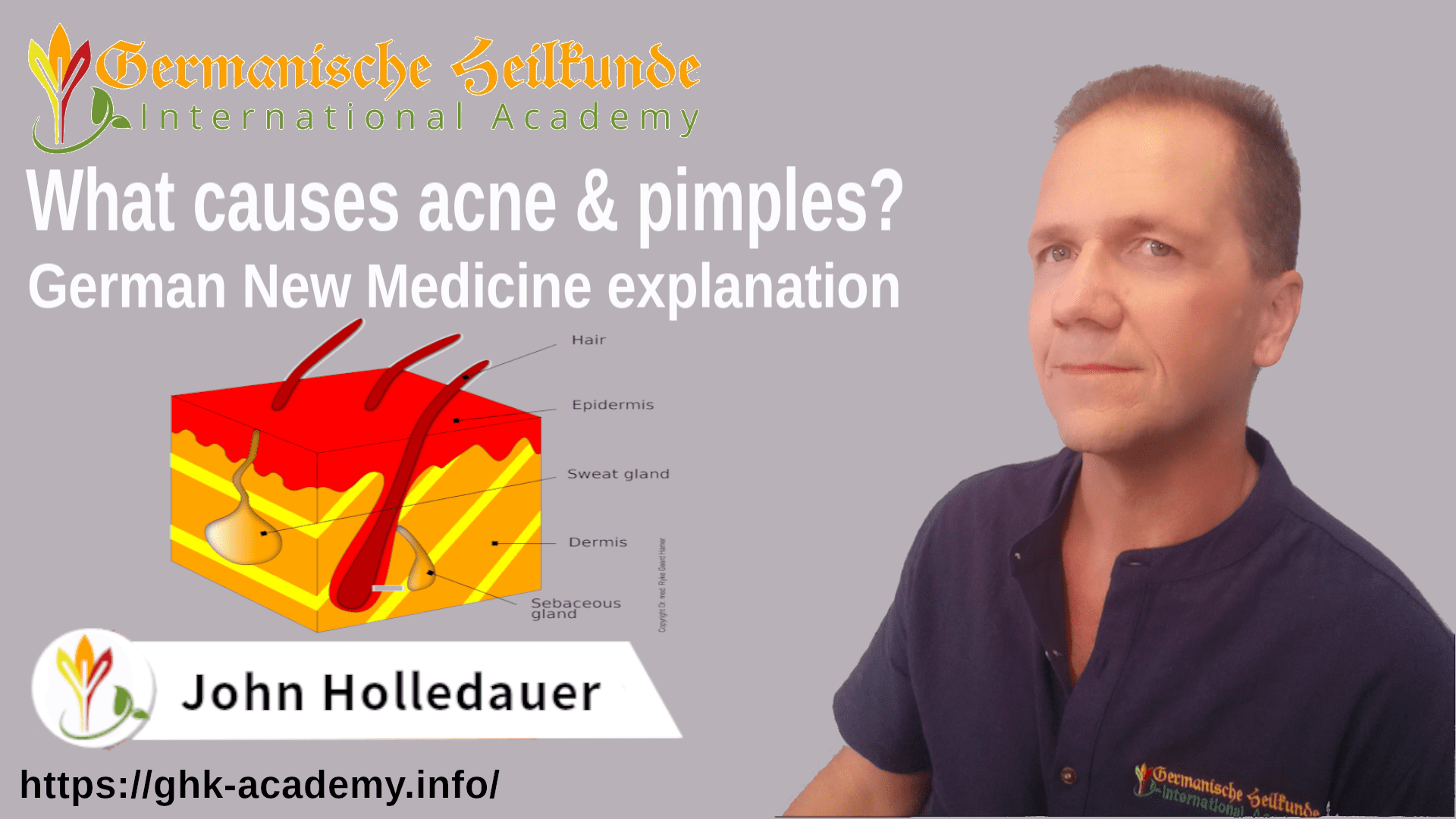 What are Causes of Acne and Pimpels? - GHK Academy