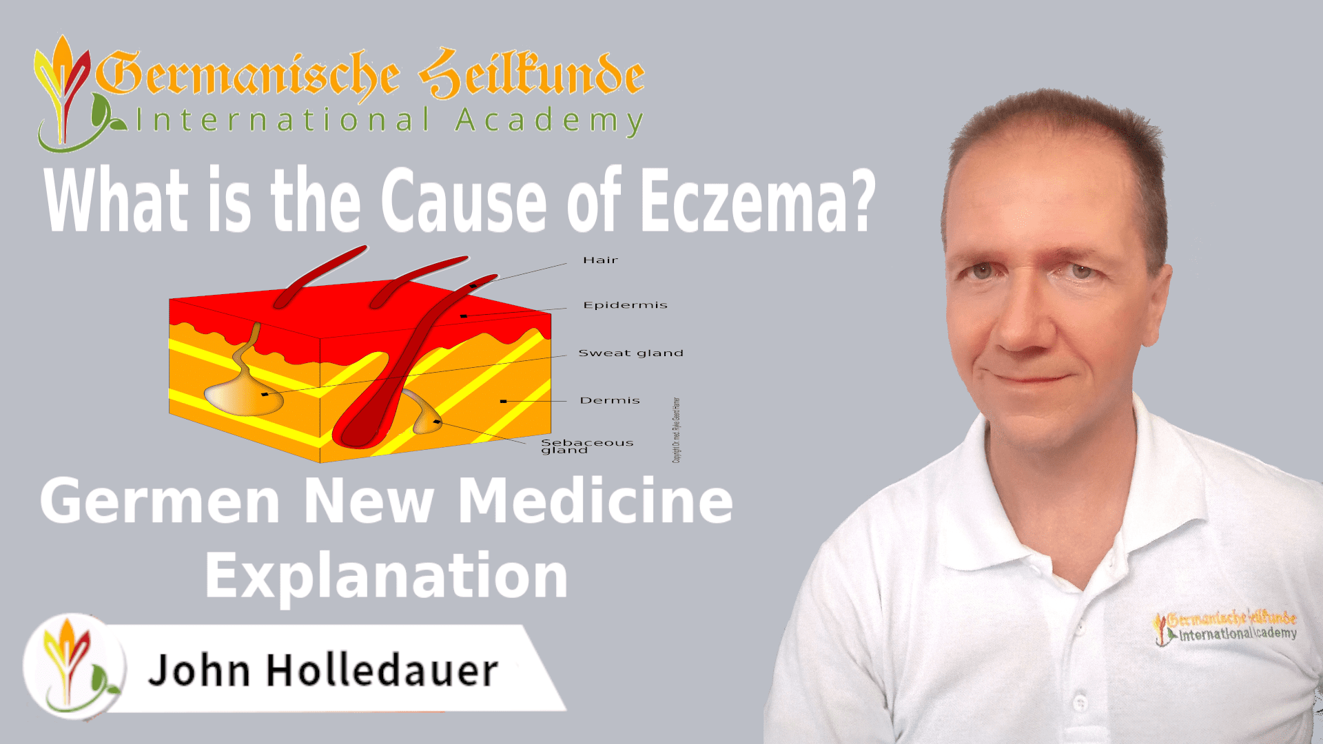 What is the Cause of Eczema? - GHK Academy